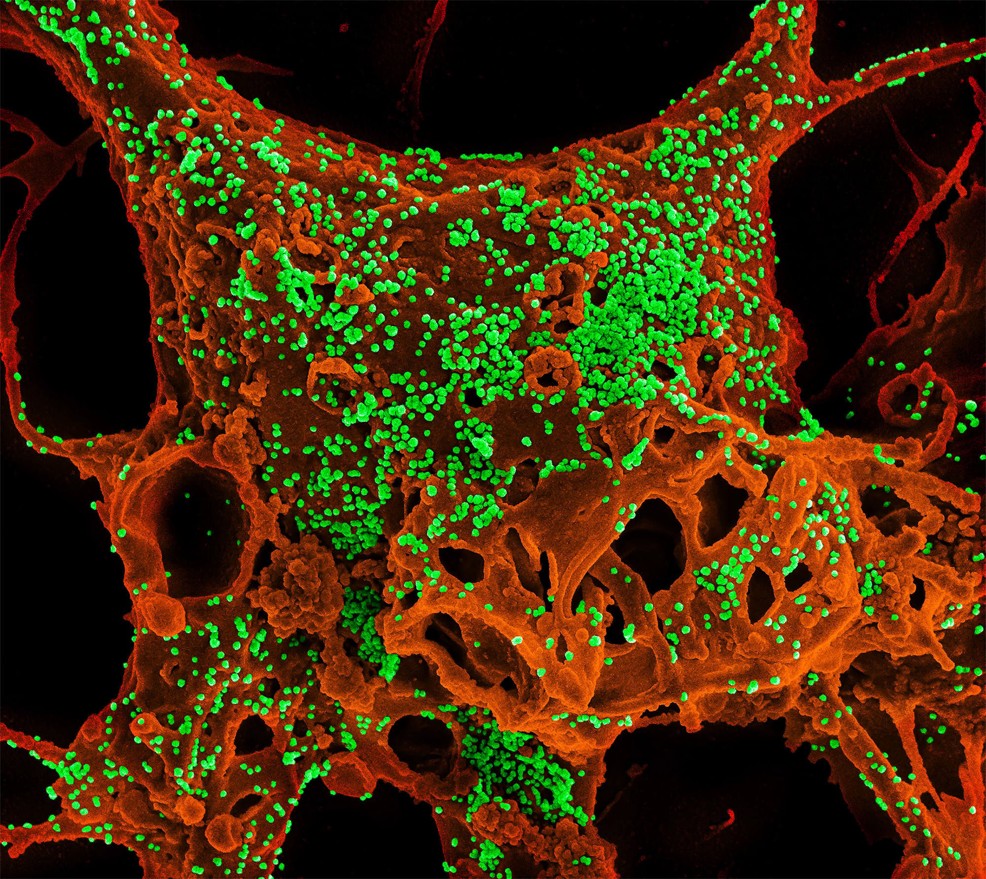 Experimental MERS treatments enter clinical trial | National Institutes ...