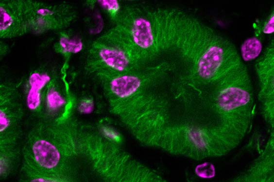 Squirrel hibernation tricks suggest medical uses | National Institutes ...