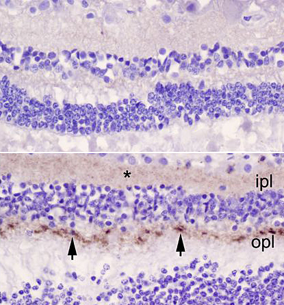 Detecting prions in eyes | National Institutes of Health (NIH)