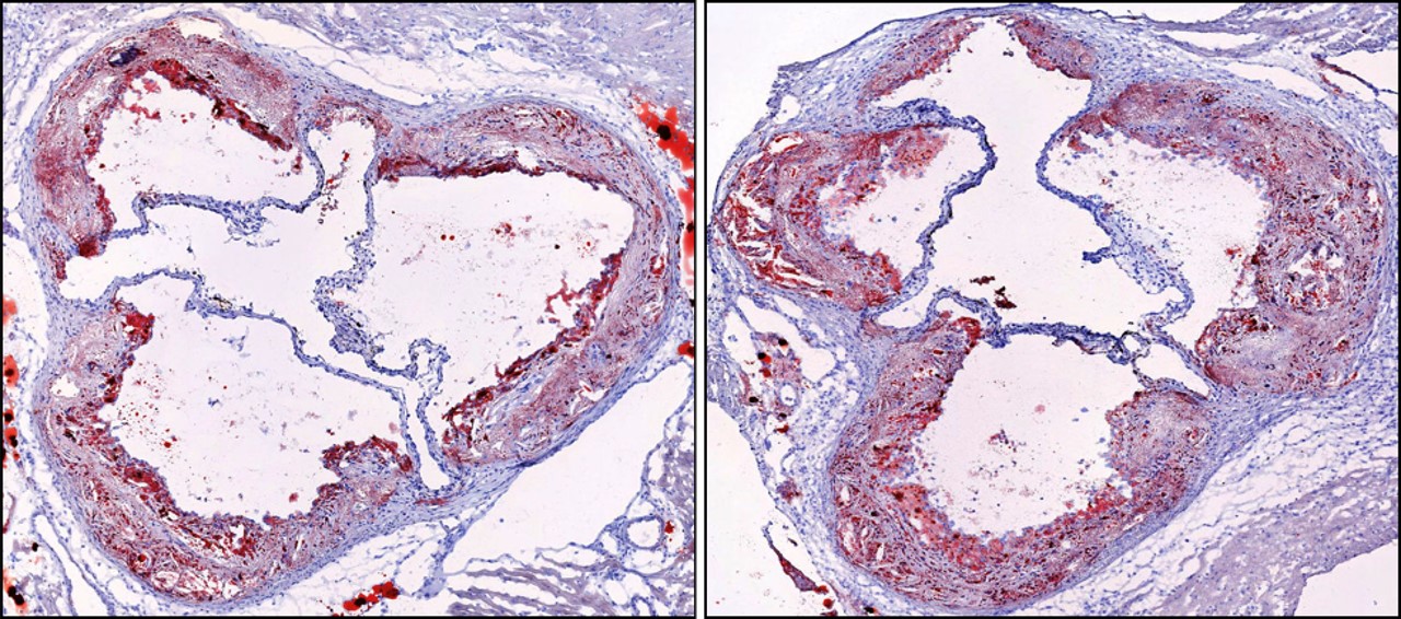 Study helps solve mystery of how sleep protects against heart disease ...
