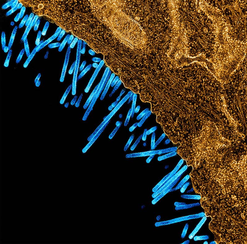 Human antibody reveals hidden vulnerability in influenza virus ...