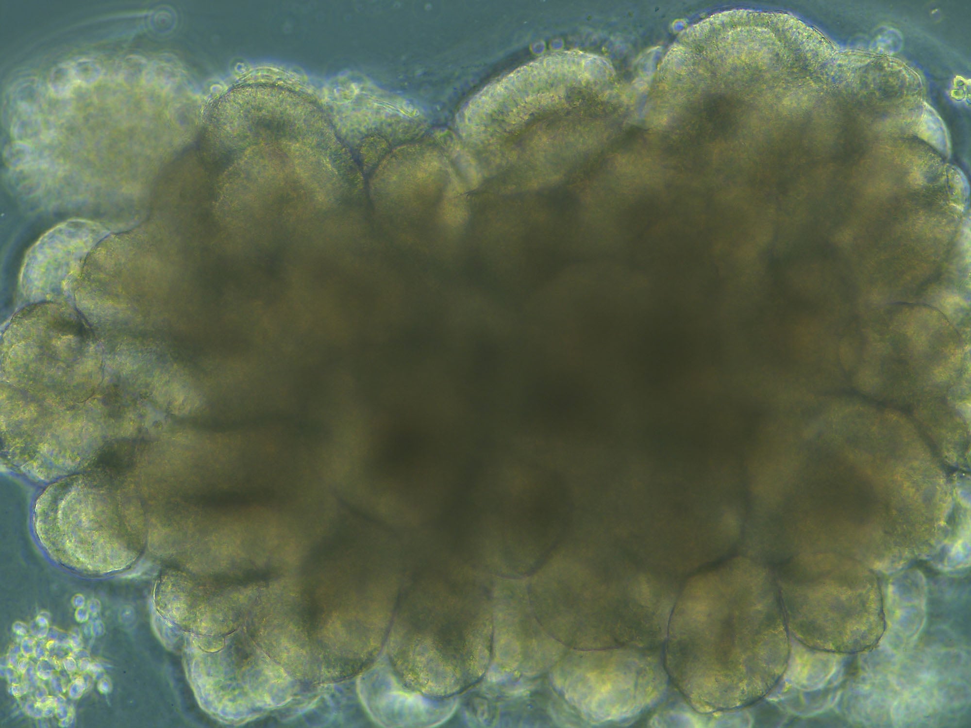 NIAID scientists develop “mini-brain” model of human prion disease ...