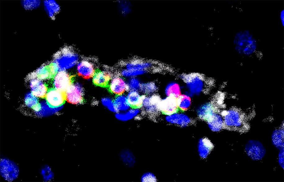 NIH study supports new approach for treating cerebral malaria ...
