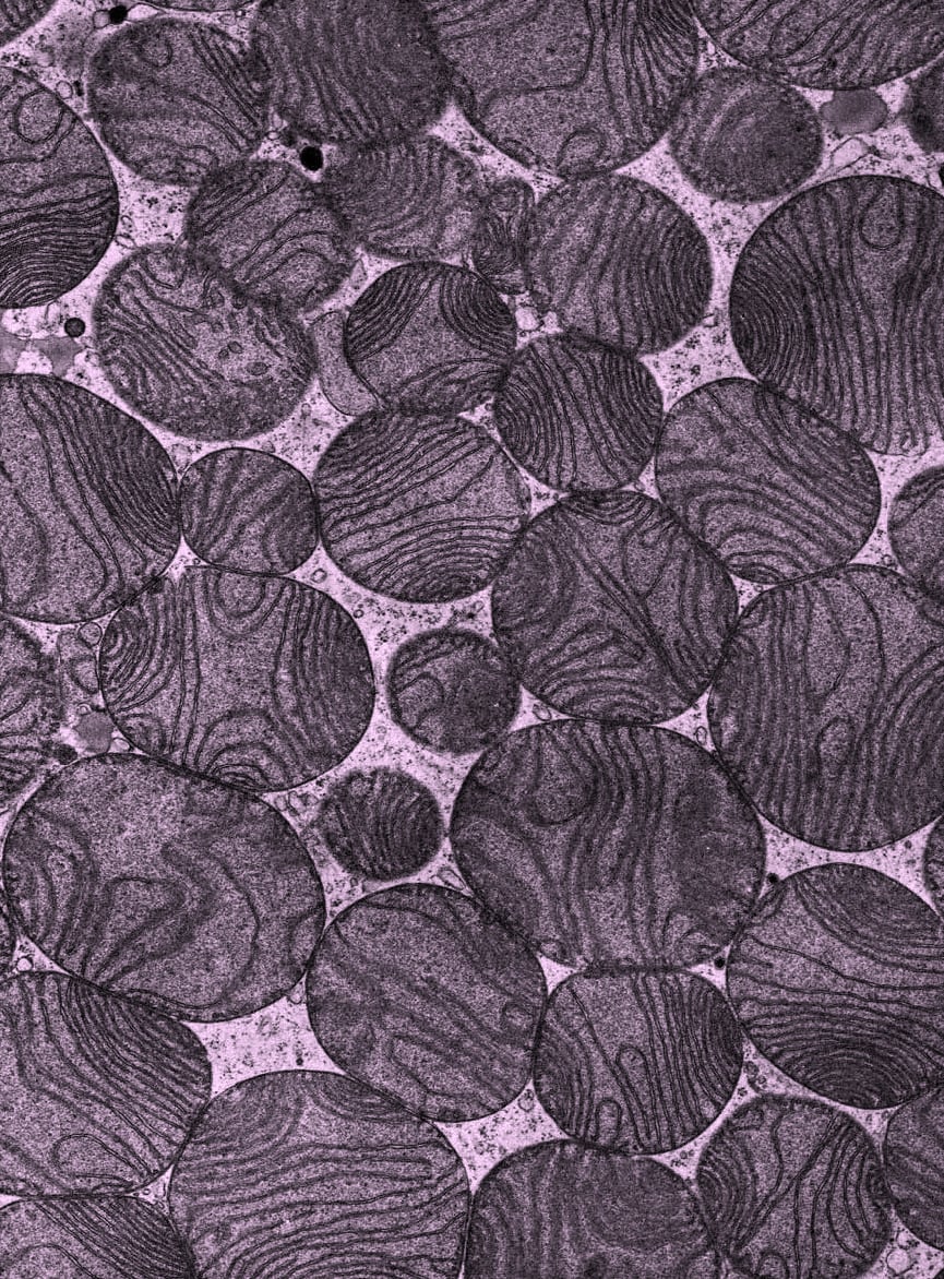 Uncovering the origins of brown fat | National Institutes of Health (NIH)