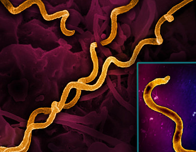 NIH awards will support innovation in syphilis diagnostics | National ...