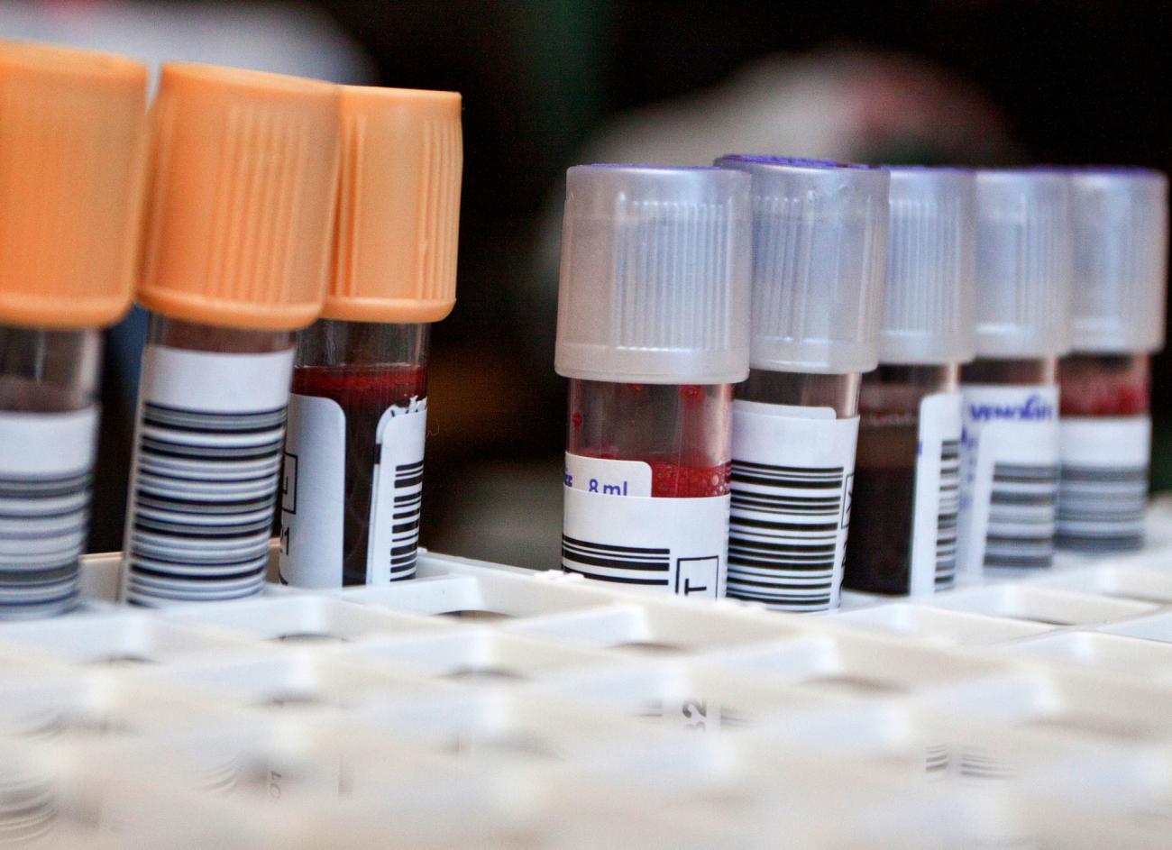Blood test detects several cancer types | National Institutes of Health ...