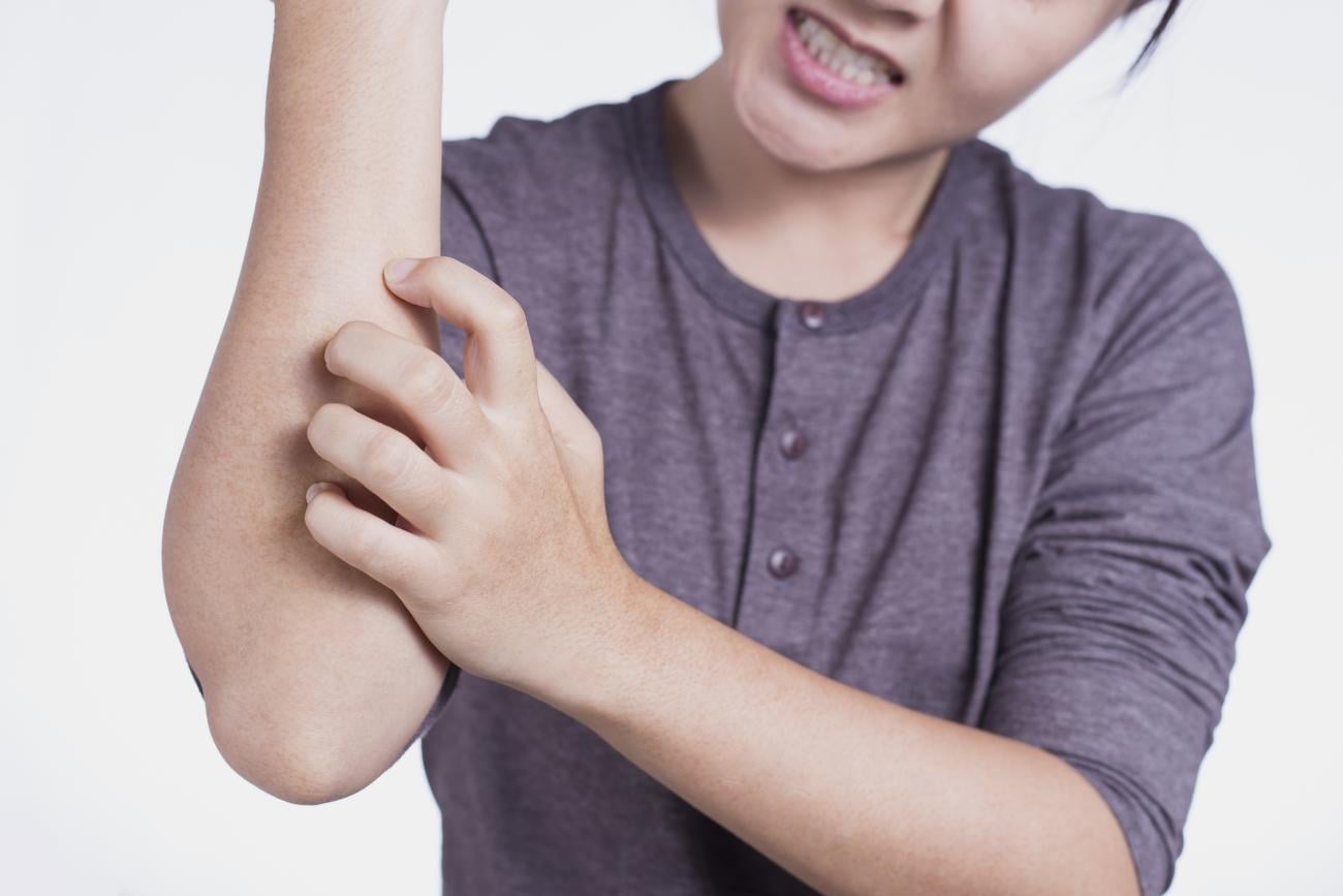 Bacteria therapy tested for common skin disease | National Institutes ...