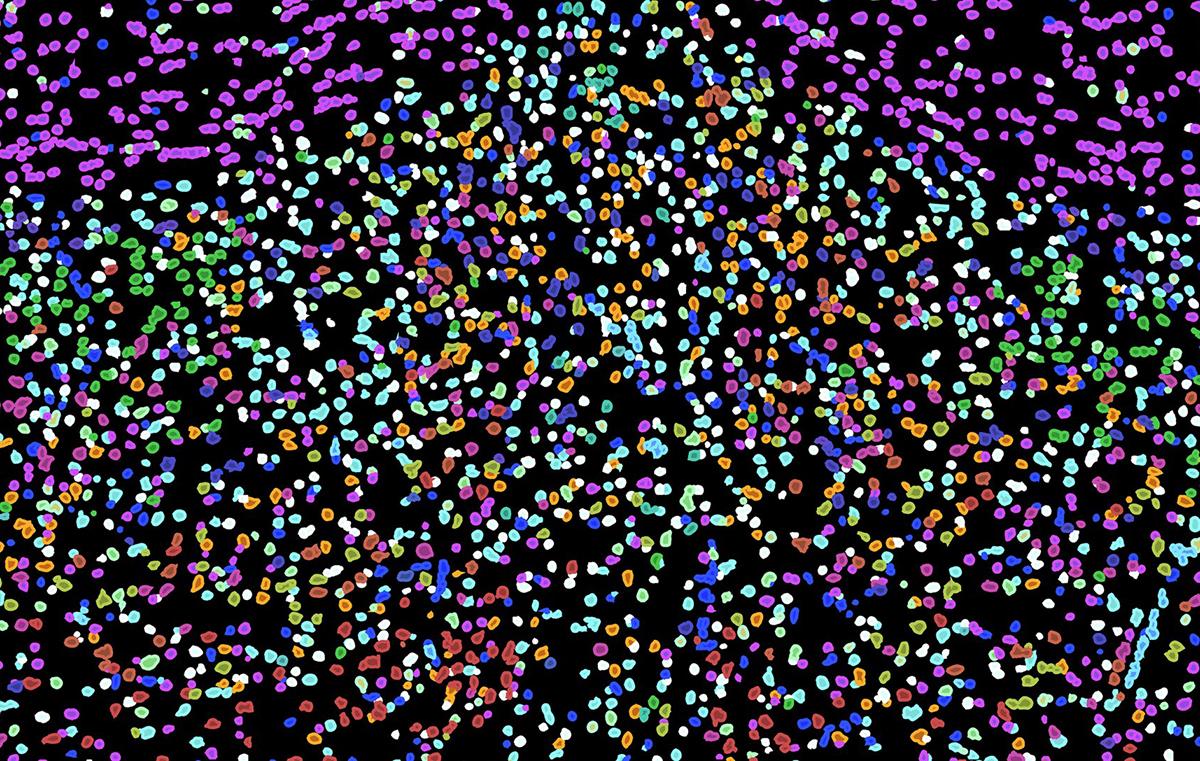 Building an atlas of brain function in mice | National Institutes of ...