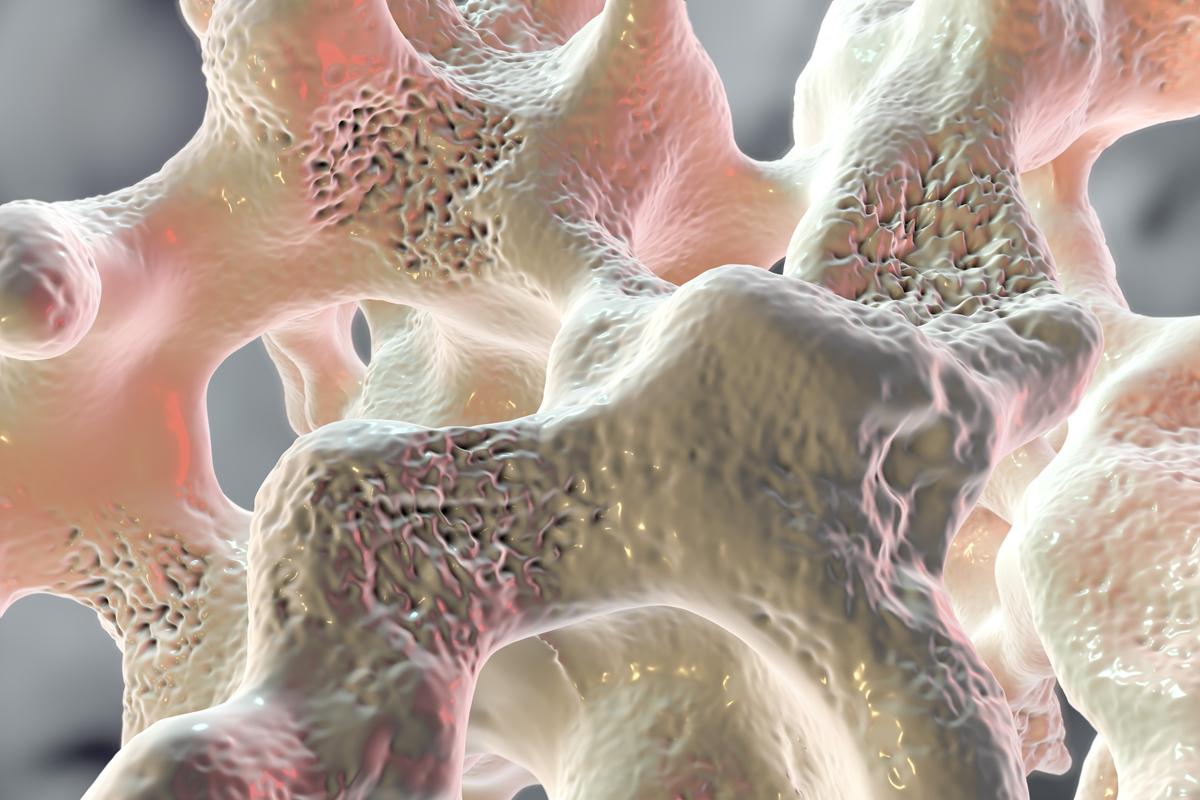 Genes linked to abnormal bone density and fracture | National ...
