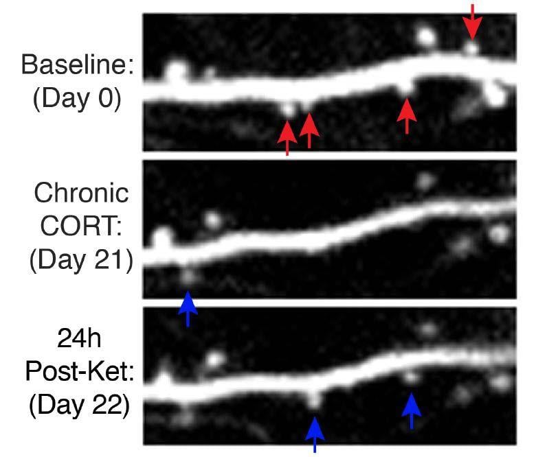 How ketamine relieves symptoms of depression | National Institutes of ...