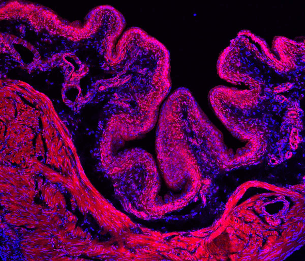 How your body senses the urge to urinate | National Institutes of ...