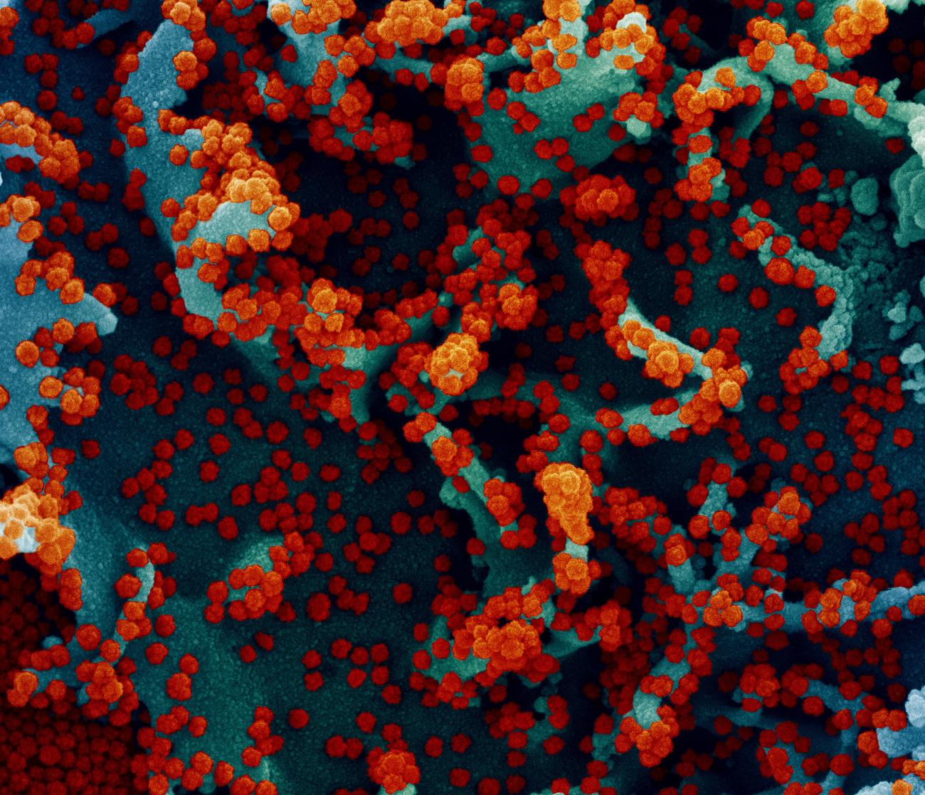 Lasting immunity found after recovery from COVID-19 | National ...