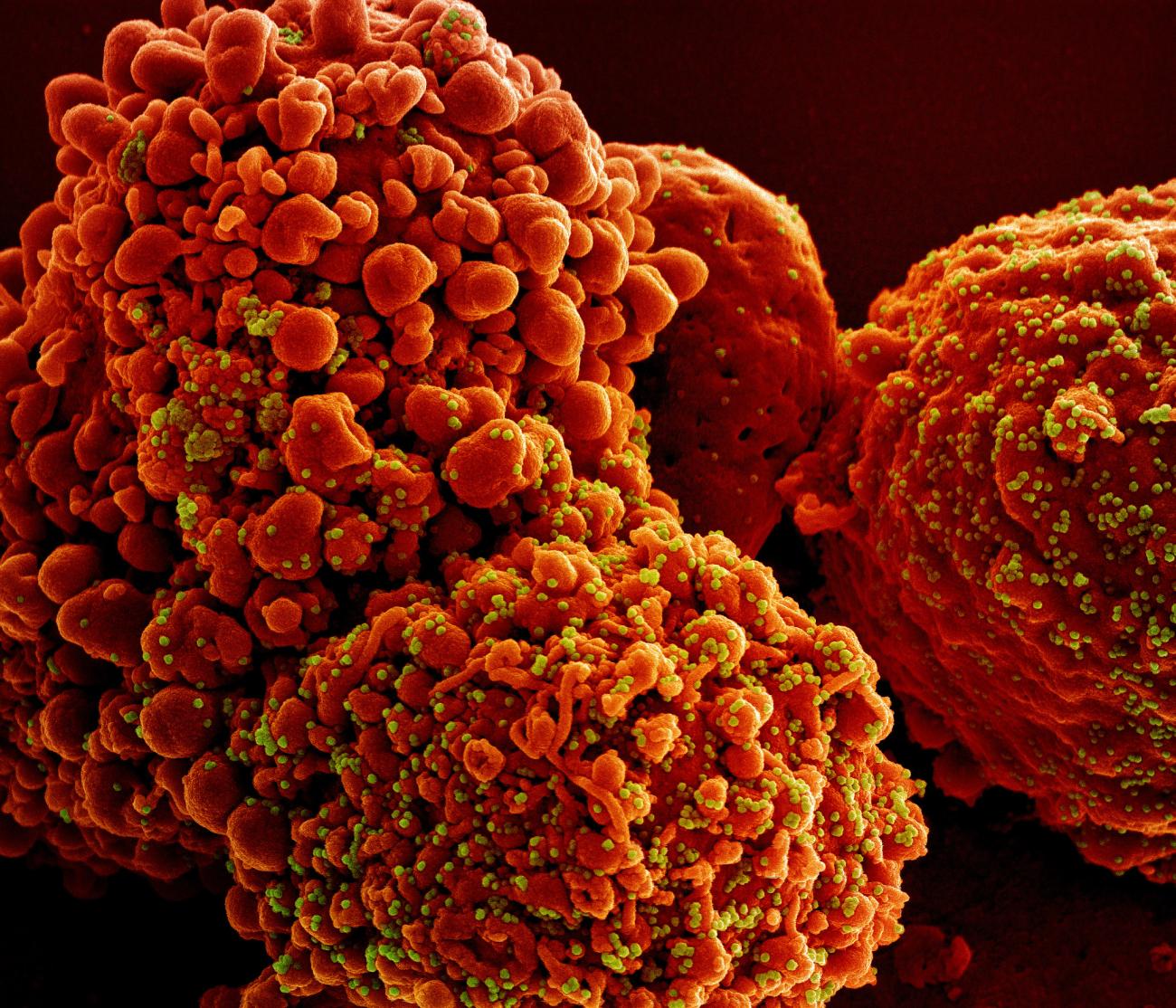 NIH-funded team develops method to identify future SARS-CoV-2 mutations ...