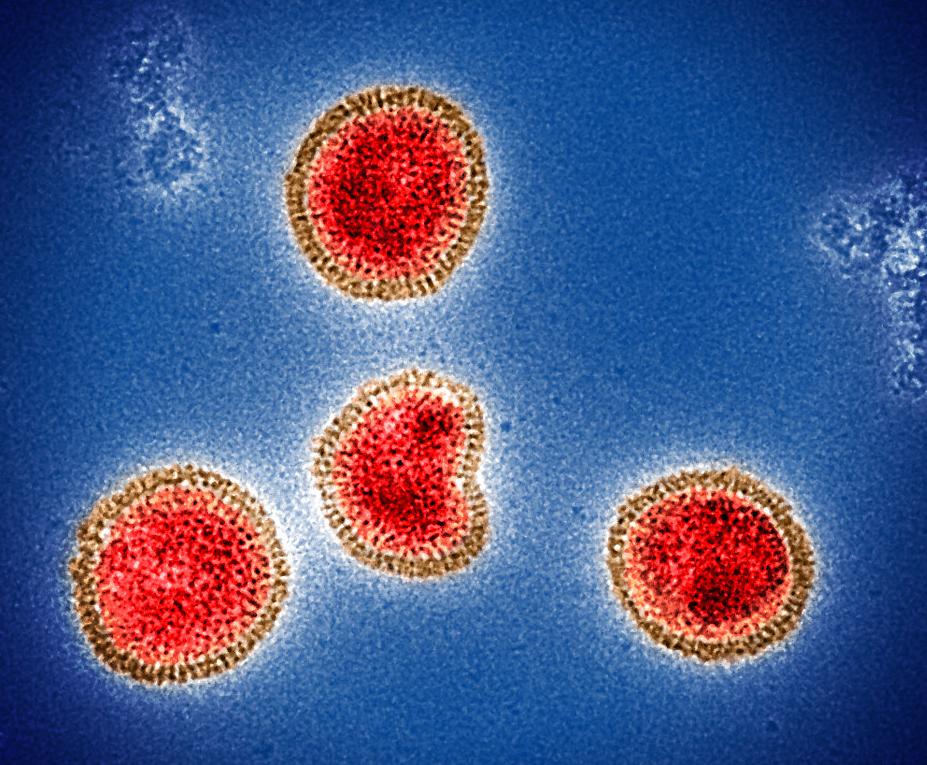 Links found between viruses and neurodegenerative diseases | National ...