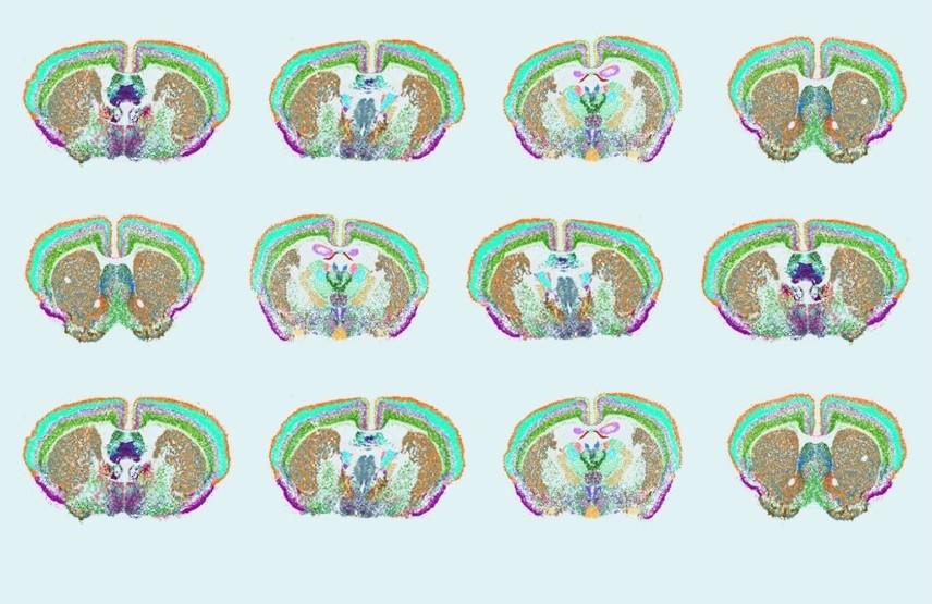 Scientists unveil complete cell map of a whole mammalian brain ...