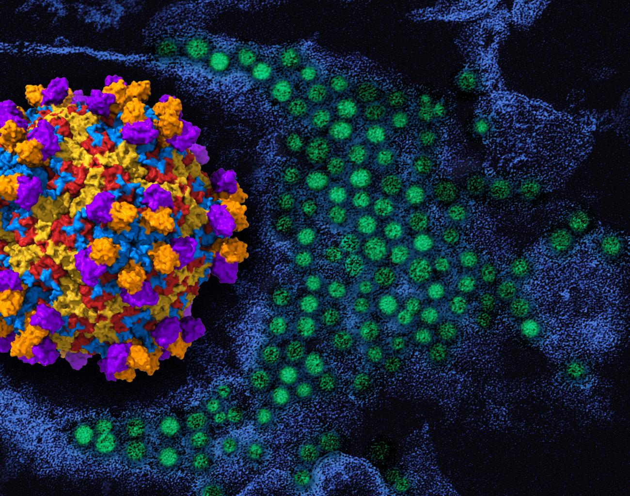 NIH-sponsored trial of enterovirus D68 therapeutic begins | National ...