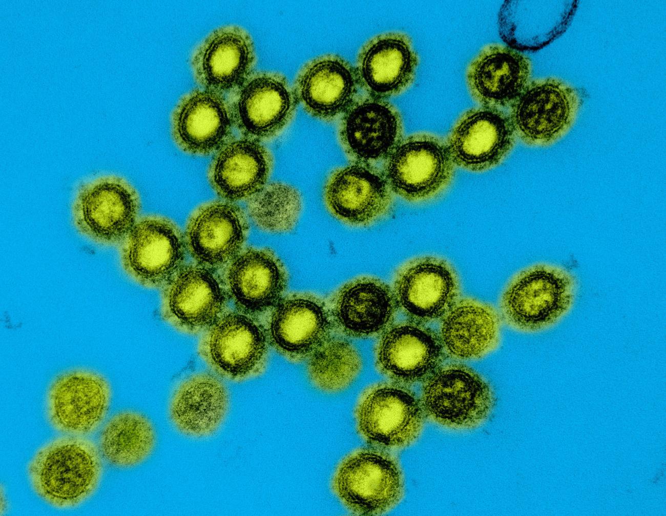 HHS, NIH launch next-generation universal vaccine platform for pandemic-prone viruses | National ...