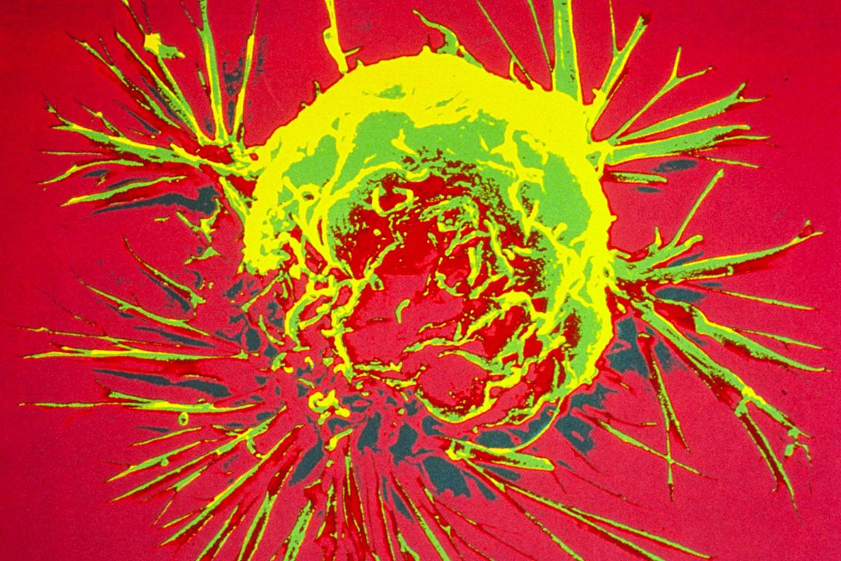 Cancer | National Institutes of Health (NIH)