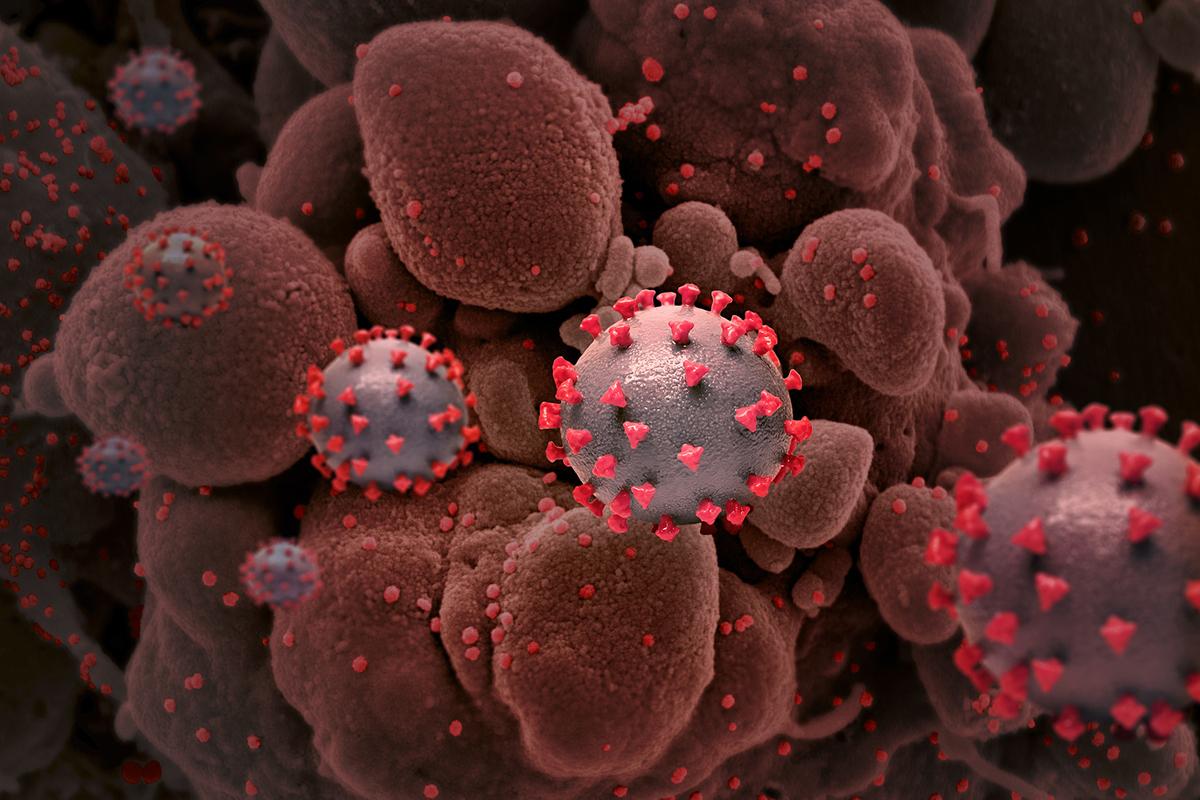 Immune System | National Institutes of Health (NIH)