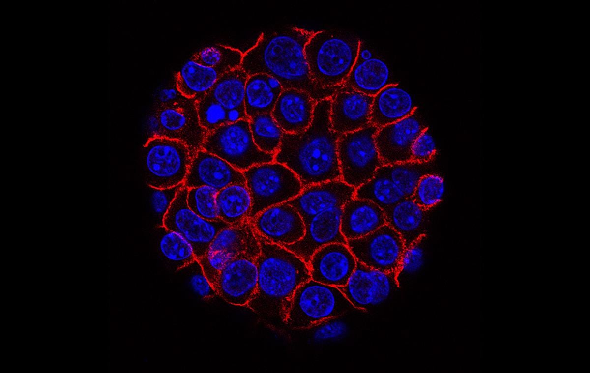 Cancer | National Institutes of Health (NIH)