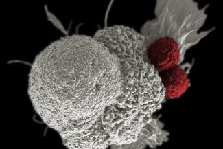 Cancer | National Institutes of Health (NIH)