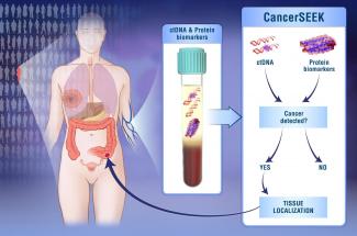 Blood test detects several cancer types | National Institutes of Health ...