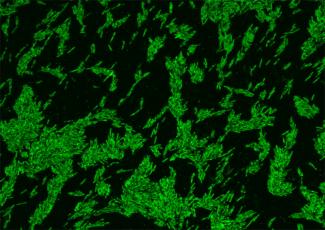 Gut bacteria may reduce cholesterol and lower heart disease risk ...