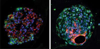 New stem cell identified for lung tissue regeneration | National ...