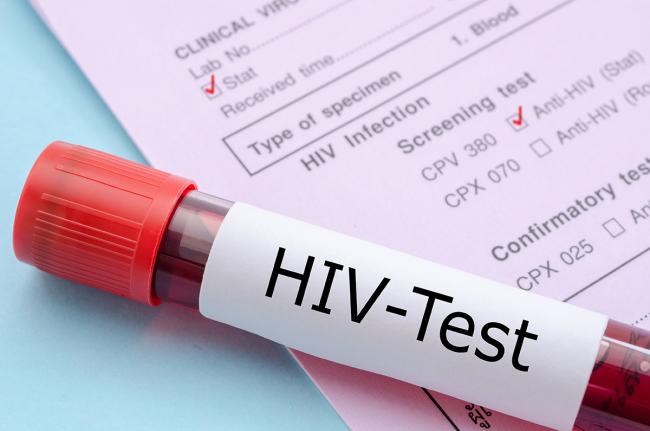 Less than a quarter of at-risk adolescent boys ever get tested for HIV ...