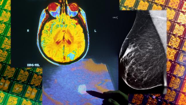 National experts chart roadmap for AI in medical imaging | National ...